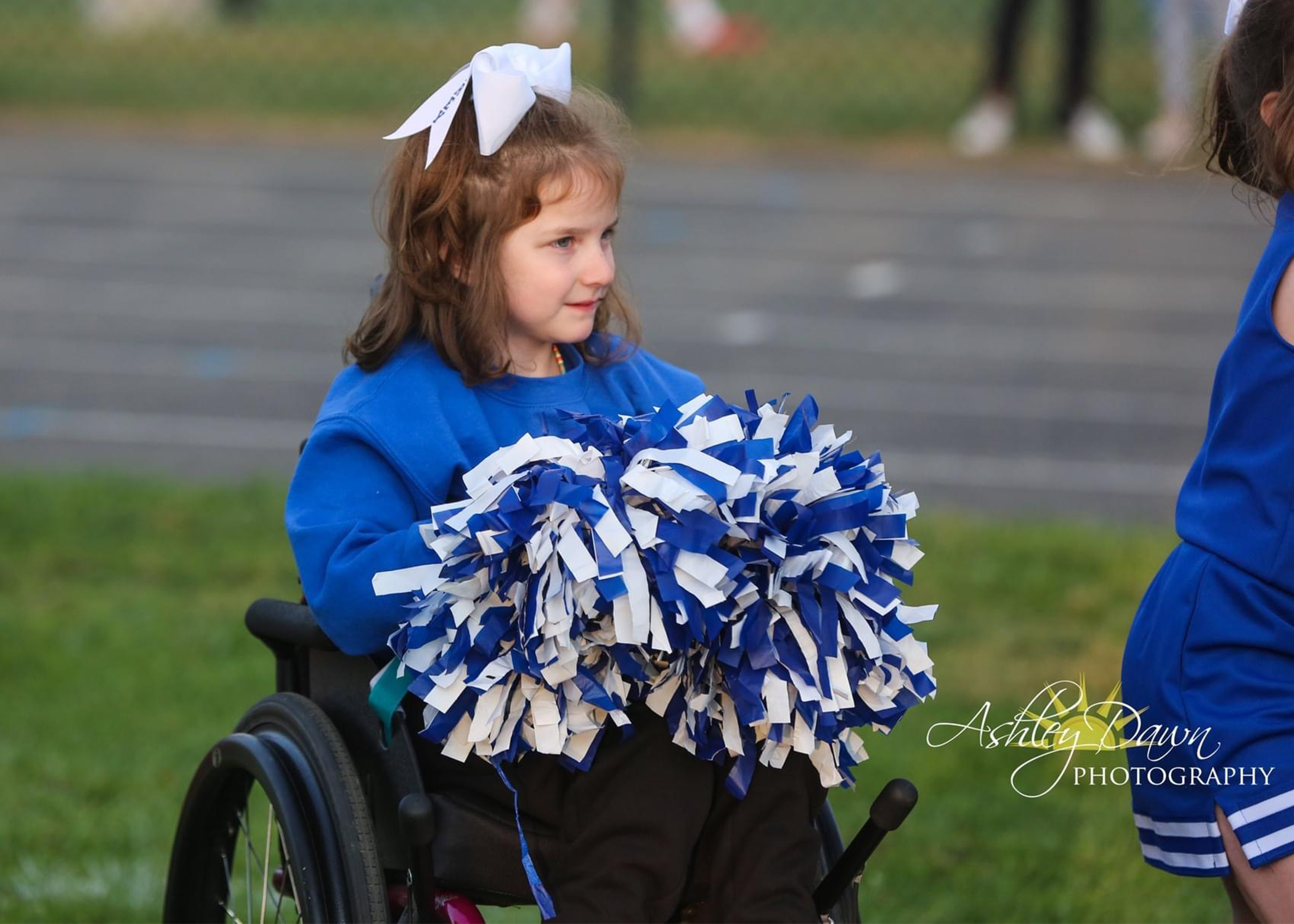Resilient, young ballerina returns to the stage after nearly losing her ...