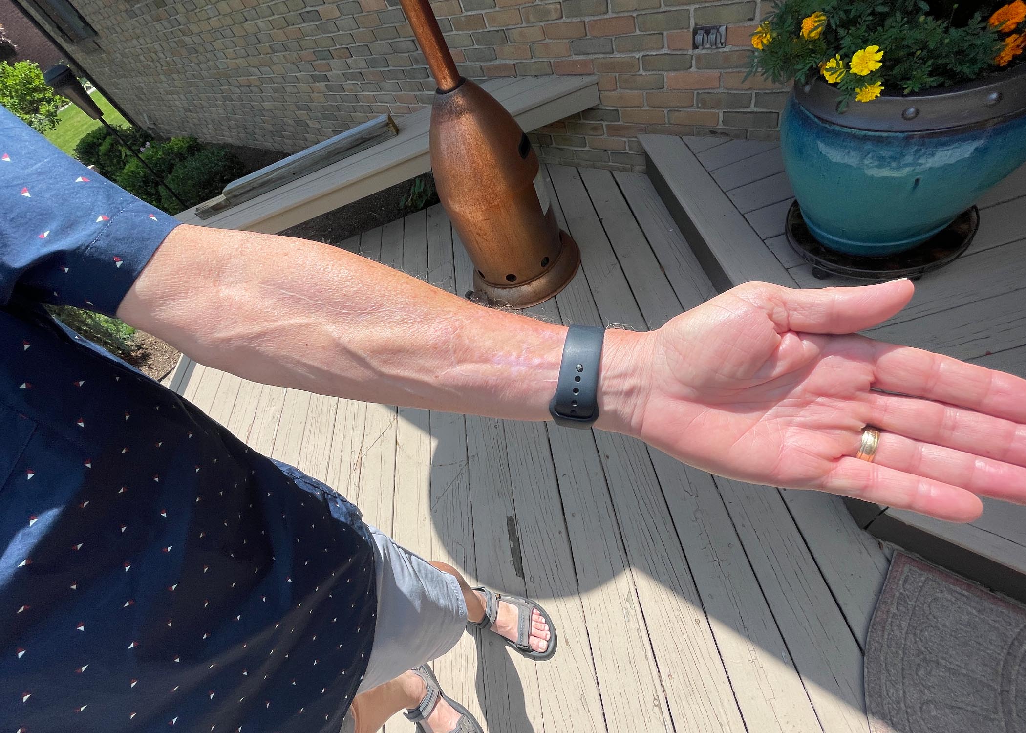 Personalizing cancer treatment with the help of 3D technology – James ...